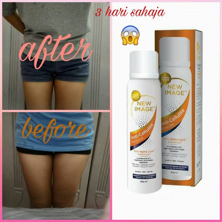 Apa Itu Alpha Lipid Anti Cellulite Mousse? - Alpha Lipid New Image